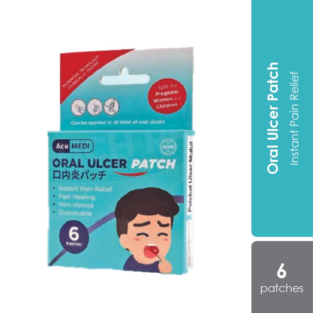 Acu Medi Oral Ulcer Patch 6s | Shopee Malaysia