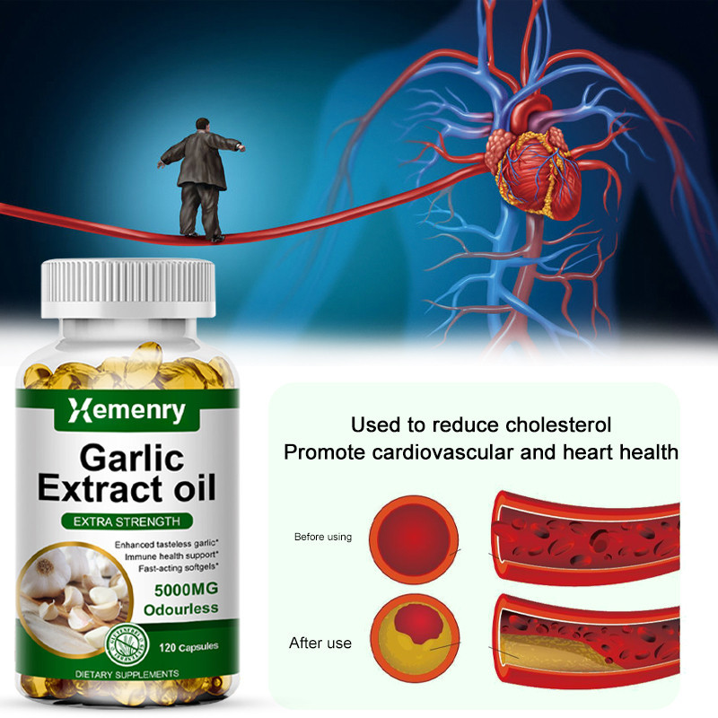 Garlic Extract Oil - Contains 5000 mg - Lowers cholesterol and supports ...