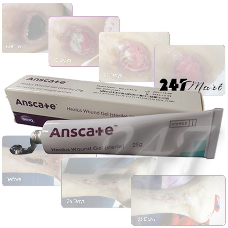 ANSCARE Healus Wound Gel (sterile) 25g | Shopee Malaysia