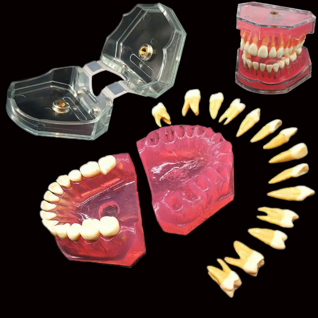 Dental Standard Typodont Model Soft Gum With 28 Removable Teeth Adult ...