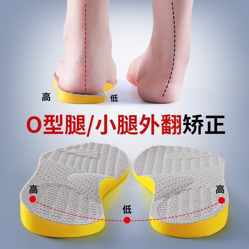 Adult Correction Insole xo-Shaped Leg Foot Inner Valgus Eight-Character ...