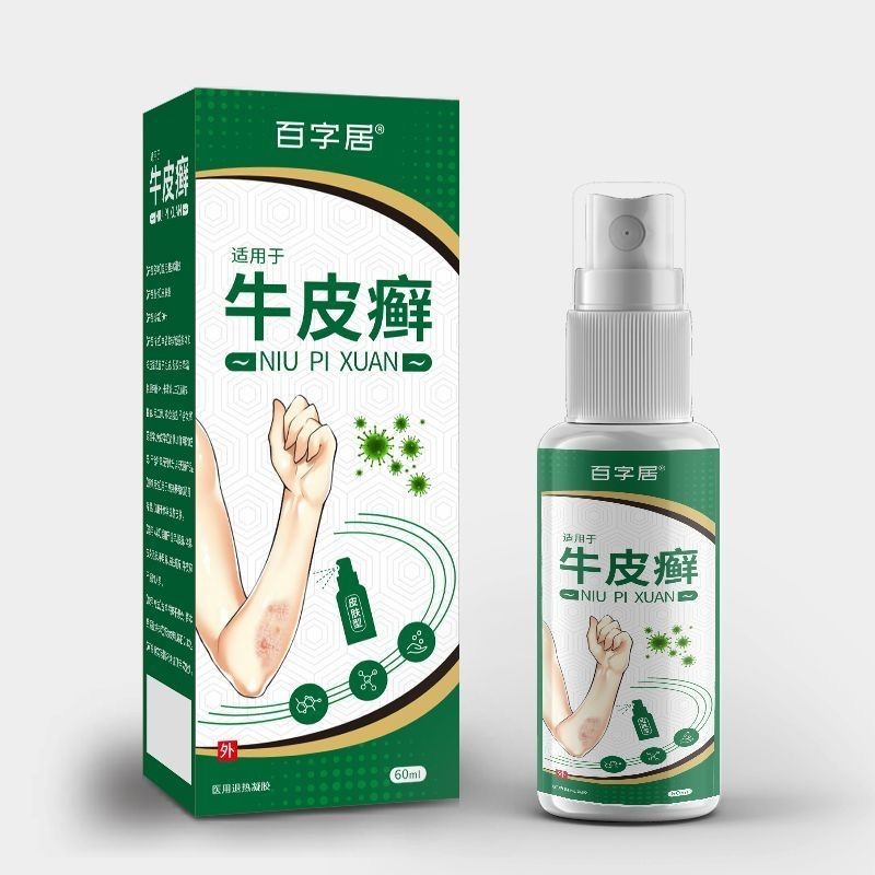 Baiziju psoriasis and psoriasis special eczema tinea capitis body tinea ...