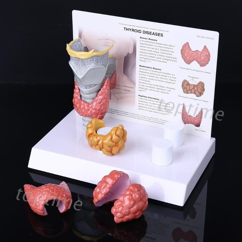 Human Anatomical Thyroid Gland Model Pathology Anatomy Digestive System ...