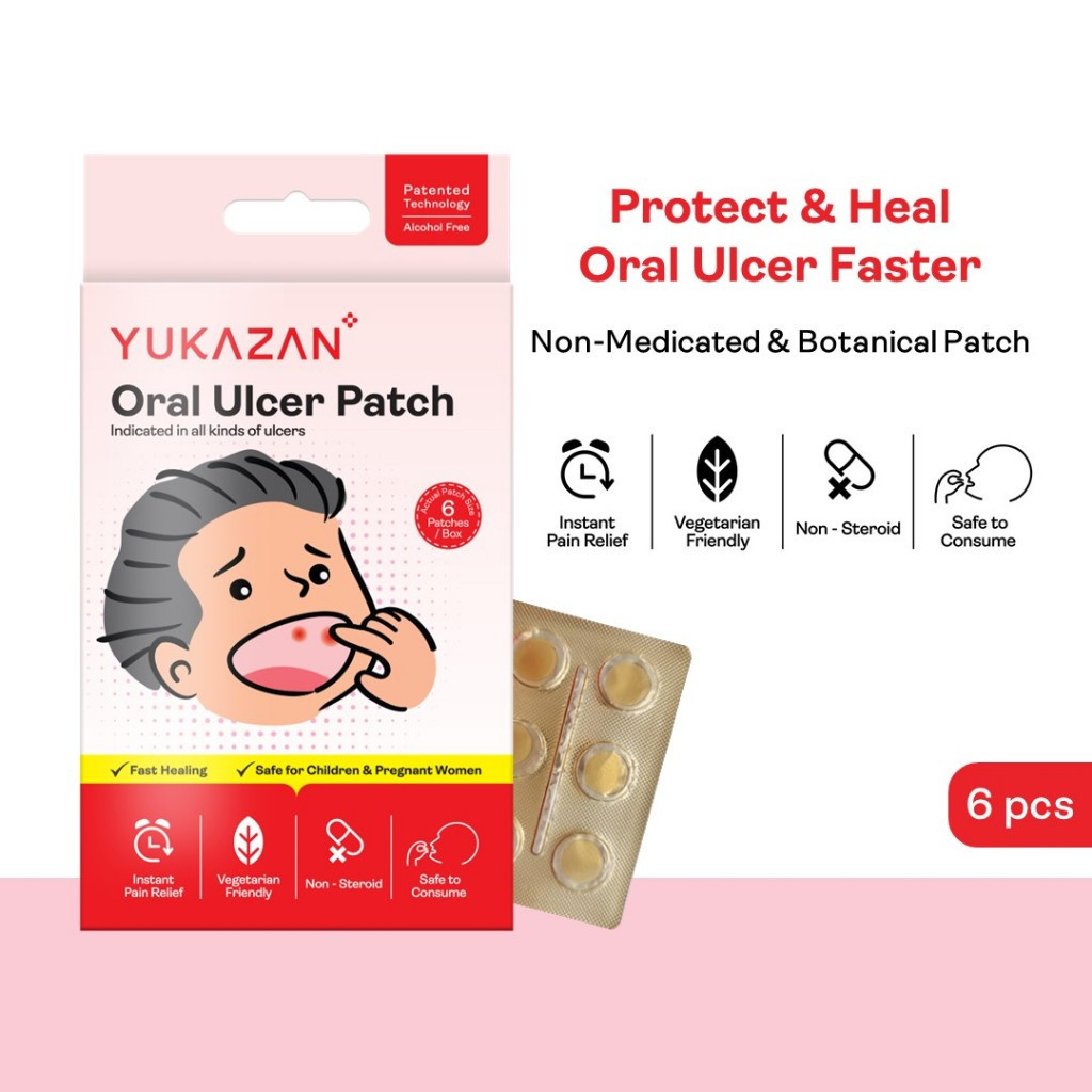 *YUKAZAN* MKA Oral Ulcer Patch For All Kind Of Oral & Canker Ulcers 6's ...