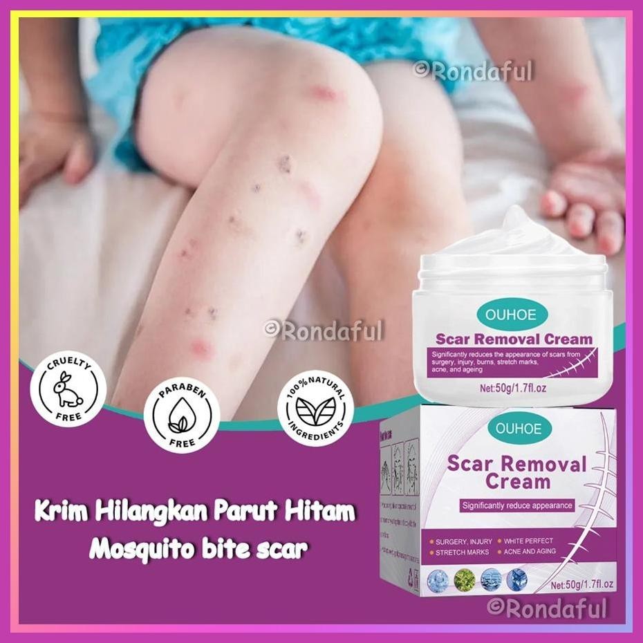 Black Scars Remove Cream Mosquito bite scar Repair Old Scars Scald Scar Pimple Scar Removal ...