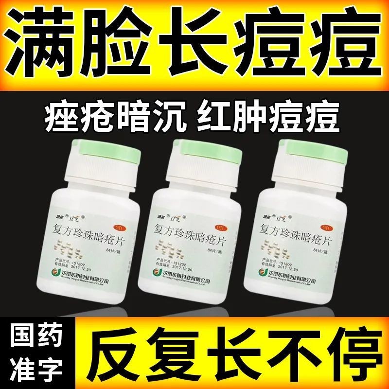 Bean Compound Pearl Acne Tablets 0.3g * 84Pcs/Box Compound Pearl Acne ...