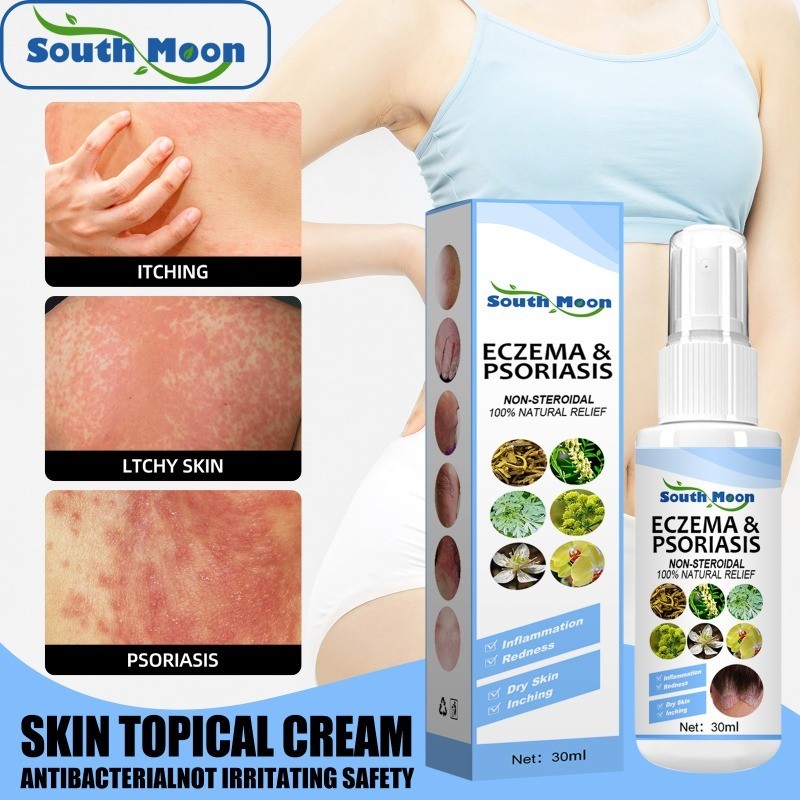 SouthMoon Skin Topical Spray Antibacterial Cream Eczema Psoriasis ...