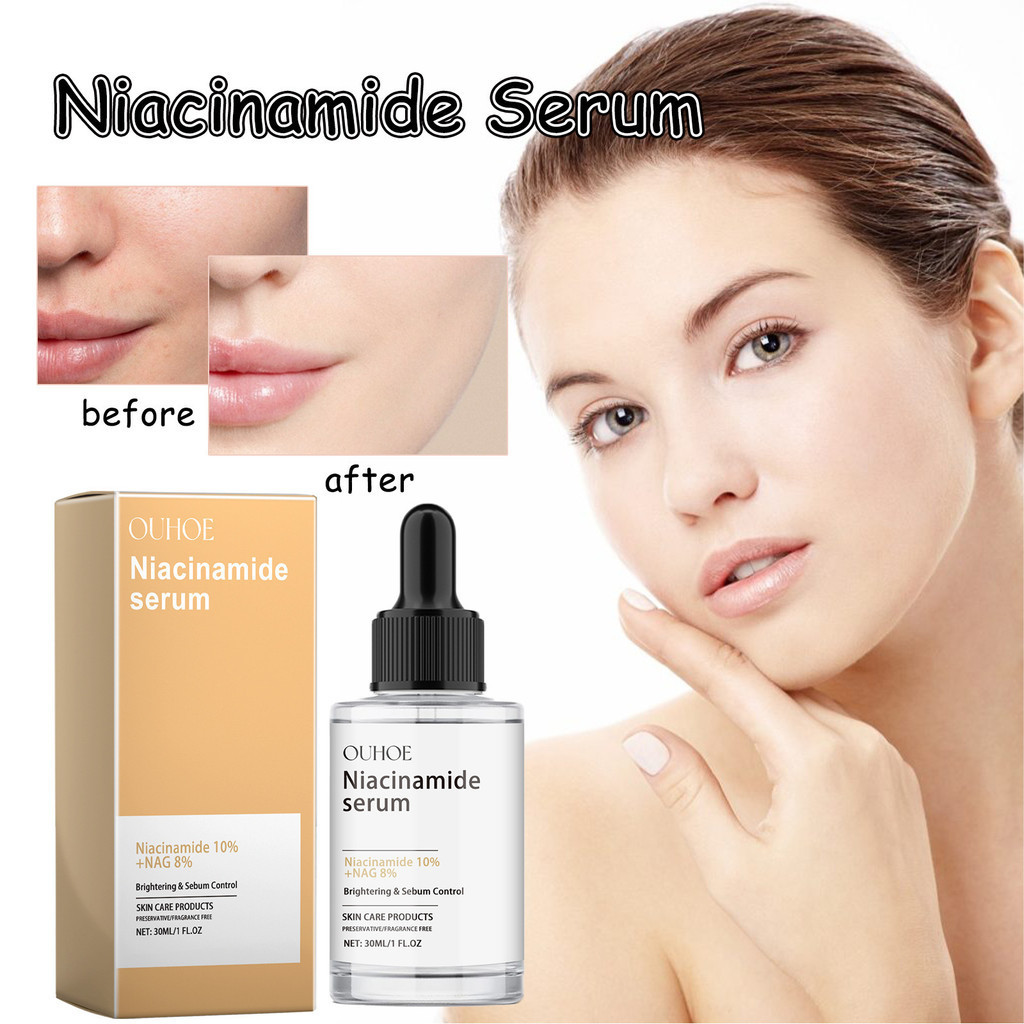 Niacinamide Essence Soft Lubricating Smooth Brightening Skin ...