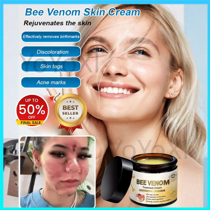 Bee Venom Fast-Acting Scar Removal Cream Halal Certified Repair Acne ...
