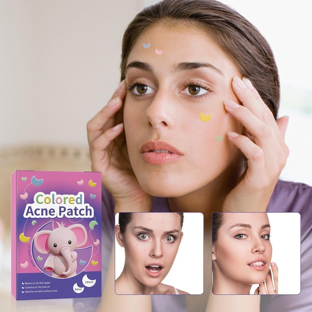 Forehead Pimple Patch 144pcs Colorful Pimple Remover Patches Pore ...