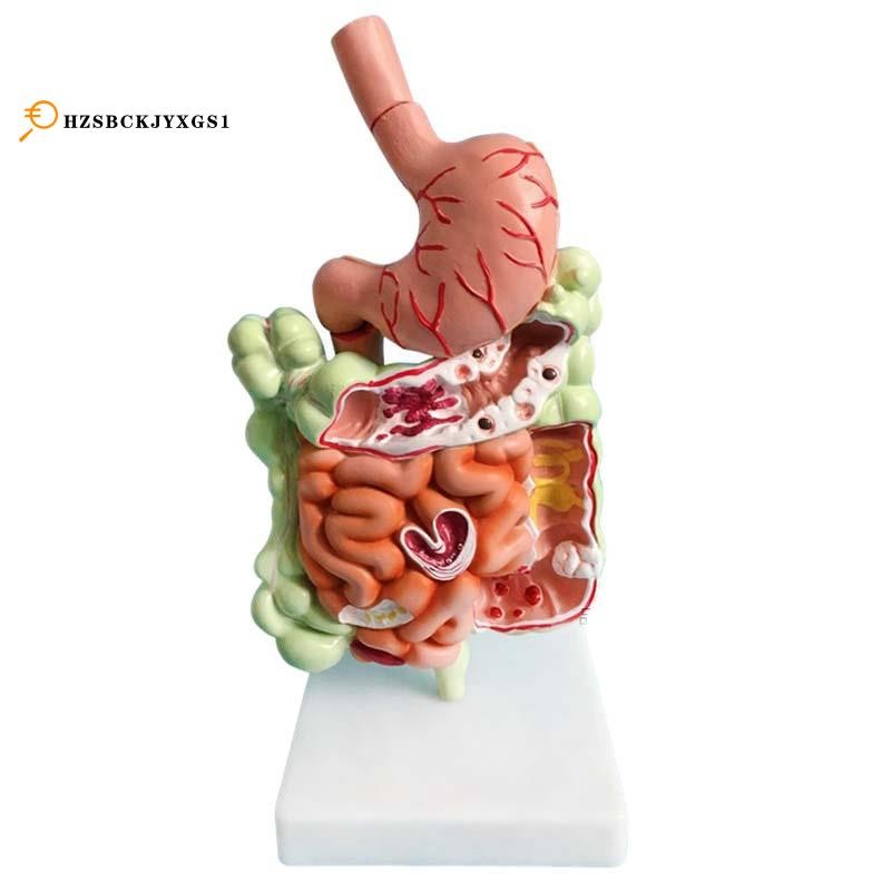 Human Digestive System Model Stomach Anatomy Large Intestine Cecum ...