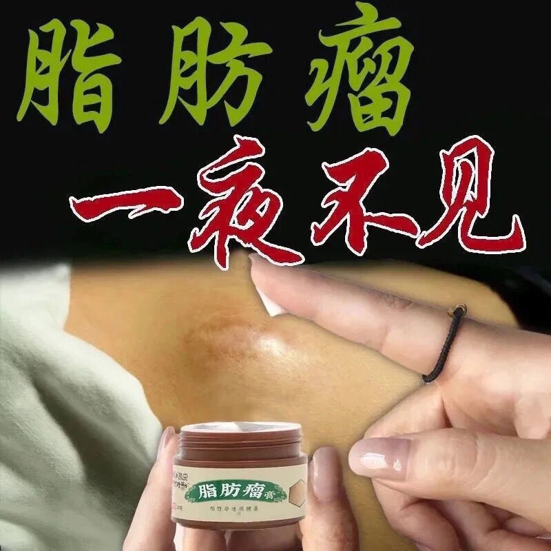 skin care Lipoma 101% Full RecoverySpecialized 36 Multiple Lipoma Under ...