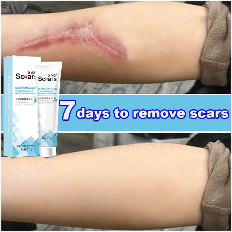 Scar Removal Cream Gel stretch mark cream acne scar treatment scar ...
