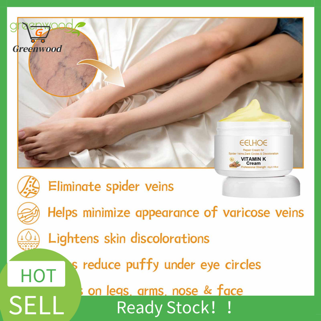 GRE Varicose Vein Leg Cream Natural Varicose Vein Cream for Healthy ...