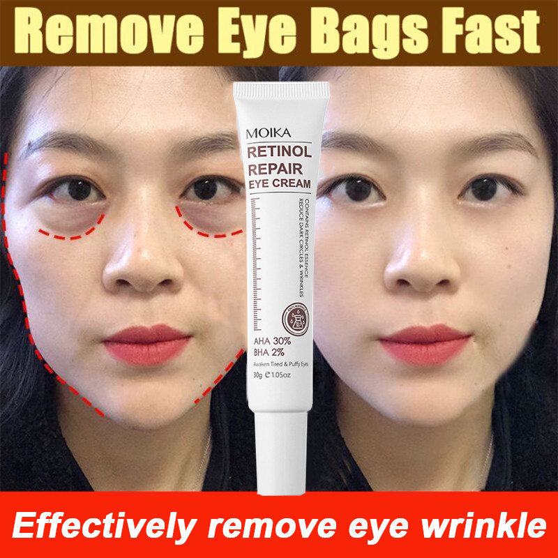 Retinol Eye Cream 30g Eyebag Remover Fades Wrinkles And Dark Circles ...
