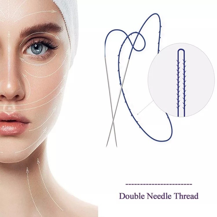 Pdo Pcl Thread For Double Needle Cones U Cog W Blunt Type 400mm Lifting ...