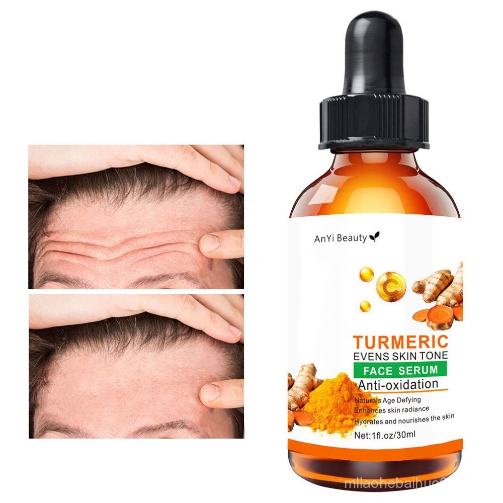 [NDC]AnYi Beauty Kunyit Face Serum 30ml Penjagaan Kulit Terkendali ...