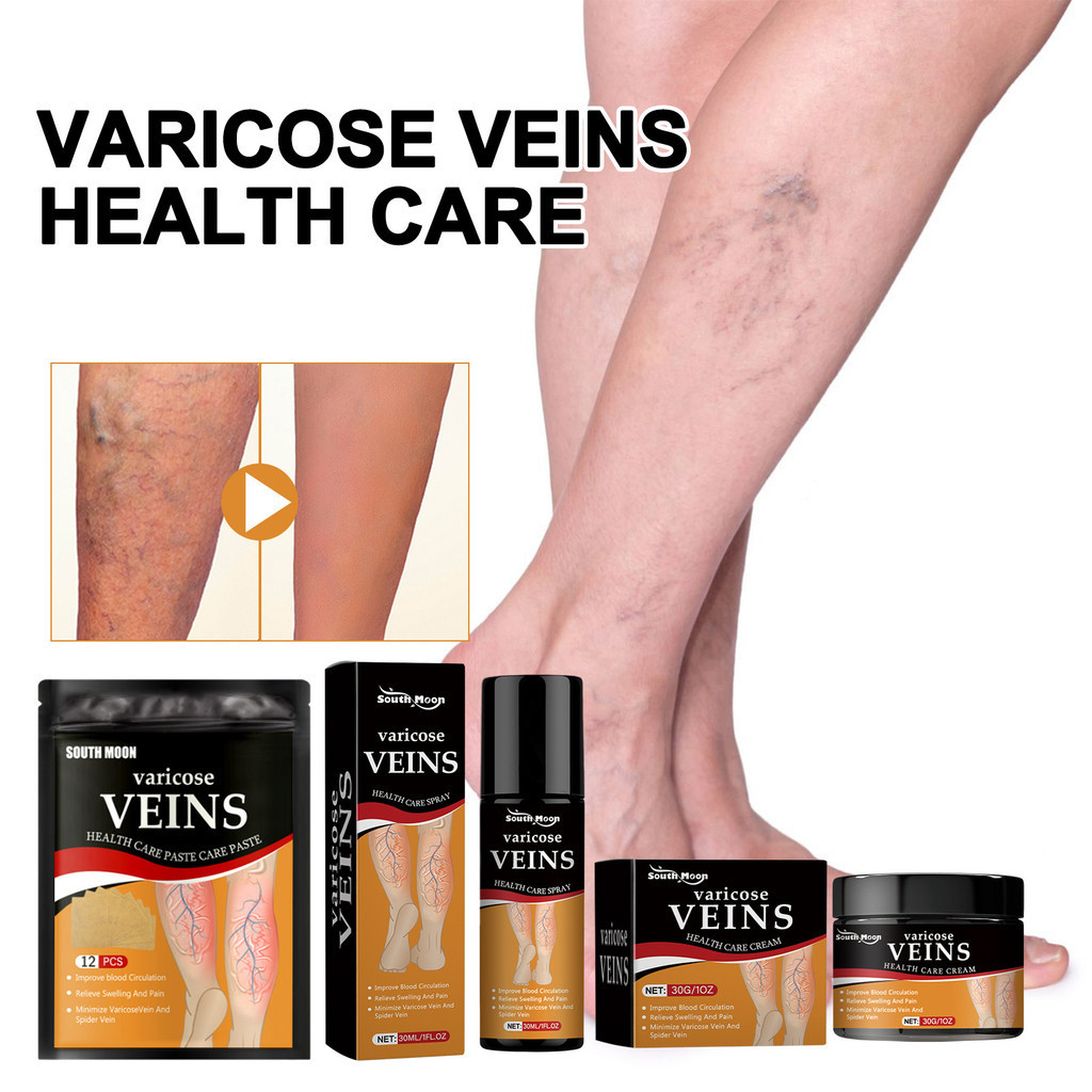 Varicose Veins Massage Cream Improves Blood Circulation Reduces ...