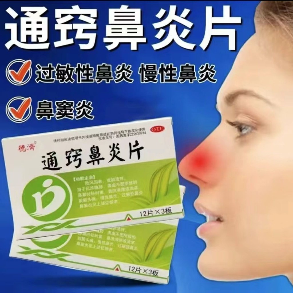 Nasal congestion, itching, runny nose, forehead headache, To Nasal ...