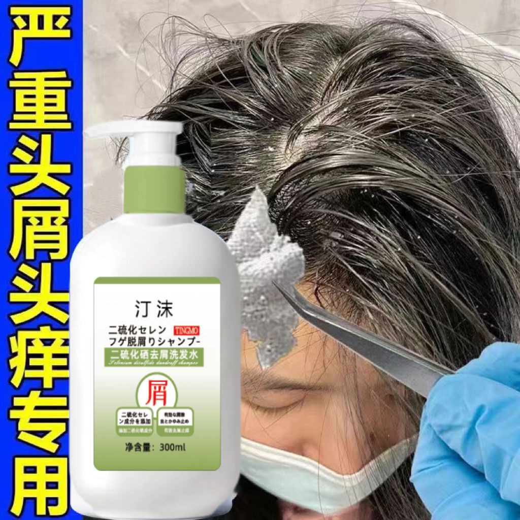 Dandruff Selenium Disulfide Anti-Dandruff Shampoo Anti-itchi Dandruff ...