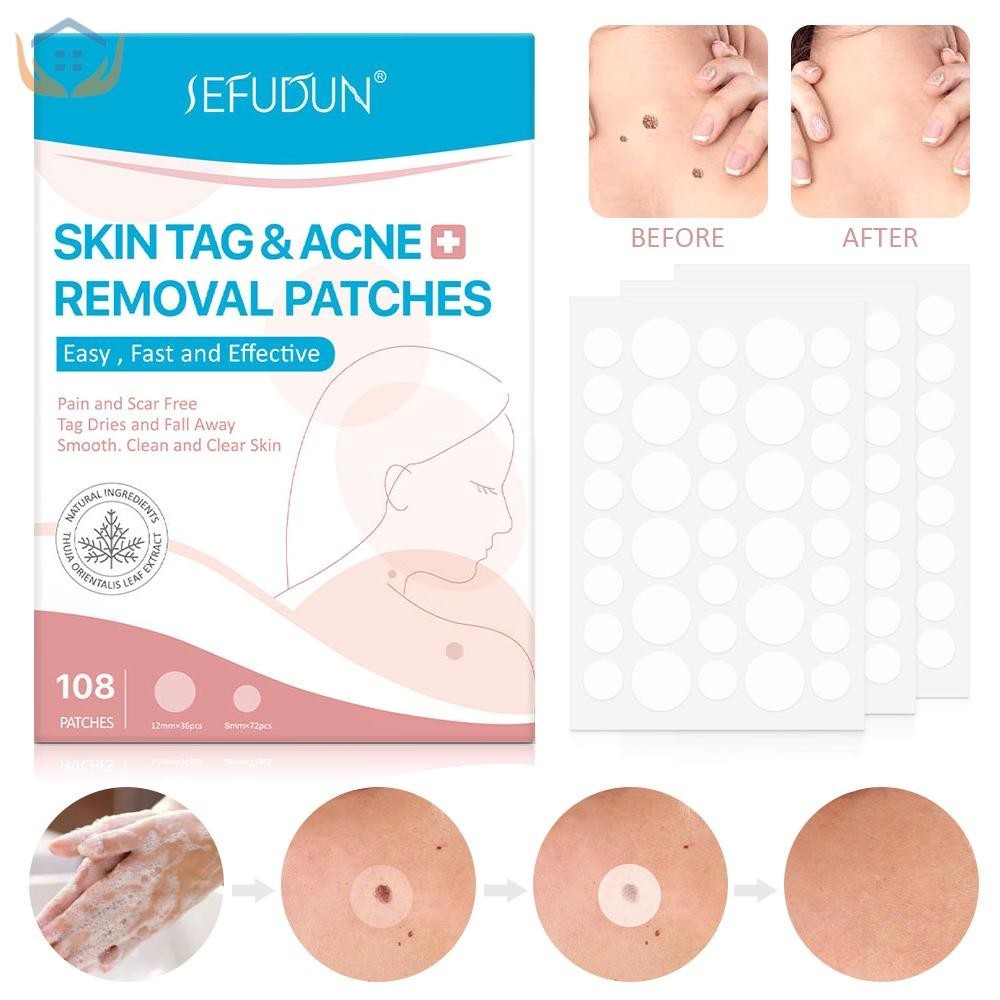 Skin Tag Remover Ance Pimple Mole Corn Patch Plaster Stickers Anti ...