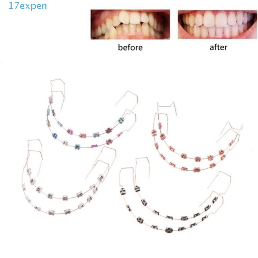 EXPEN 1 pair Temporary Tooth Decoration, Colorful with Metal Wires ...