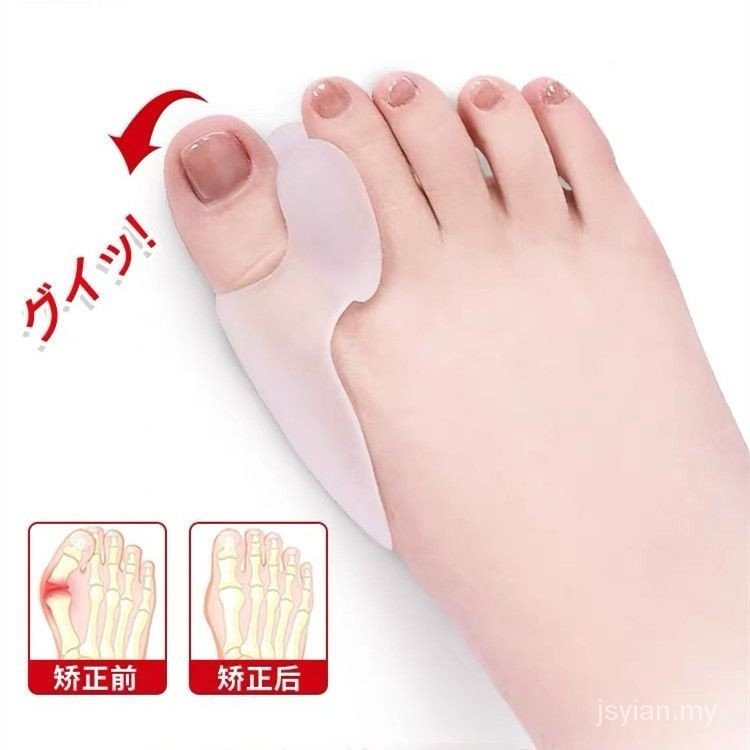 Left Right Universal Thumb Valgus Corrector Can Wear Shoes Silicone Big ...