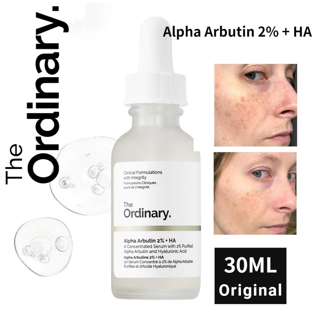 The Ordinary Alpha Arbutin 2% + HA - Dark Spots Whitening Serum Melasma ...