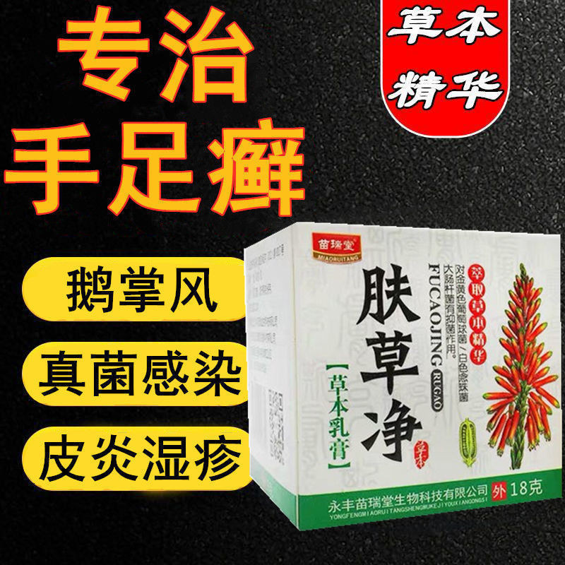 真菌感染手足癣手癣膏水泡手痒鹅掌风手干开裂脱皮湿疹瘙痒止痒膏Fungal infection, tinea manus and pedis ...