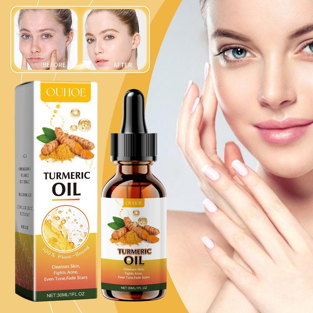 Turmeric Oil for Skin 30ml Natural Turmeric Moisturising Oil for Skin ...