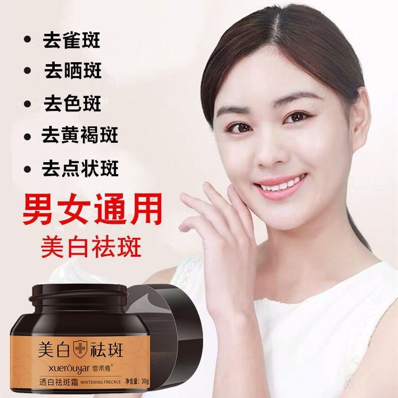 [Ready Stock] Freckle Removal Cream Remove Aging Spots Freckles ...