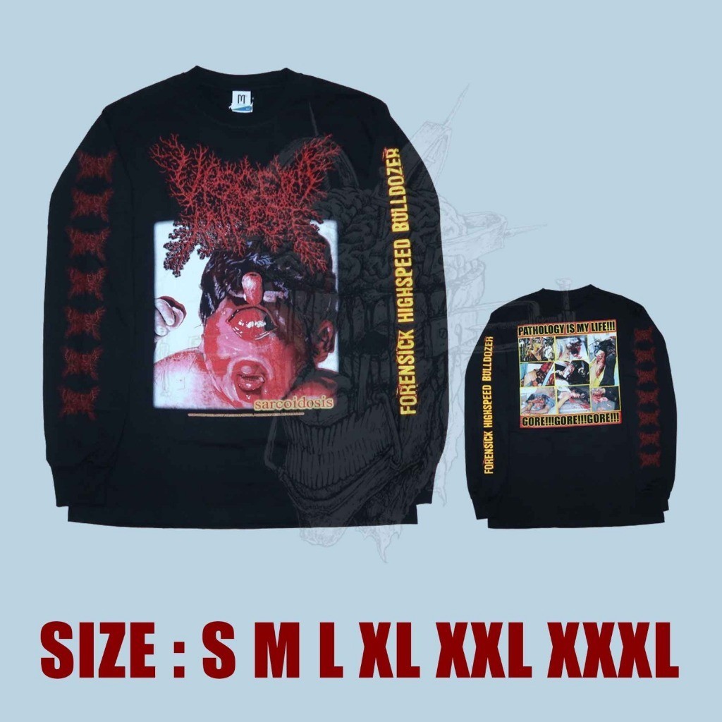 Original LS - VISCERA INFEST - Sarcoidosis | Shopee Malaysia