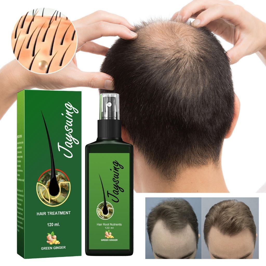Hair Growth Serum hair growth tonic Tumbuh Rambut rambut gugur 120ml ...