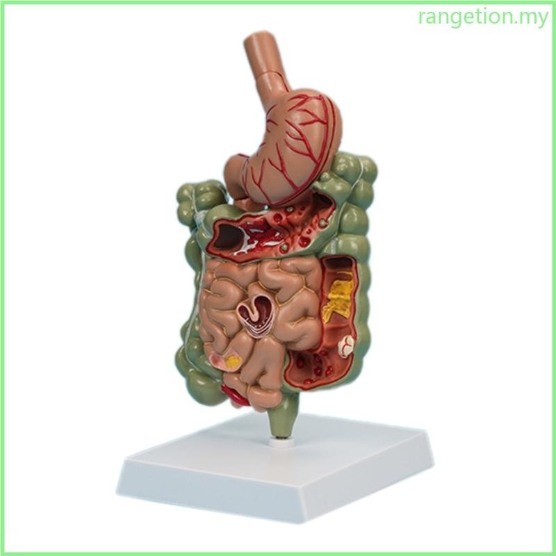 RAN Anatomical Pathological Gastrointestinal Model Stomach Intestin ...