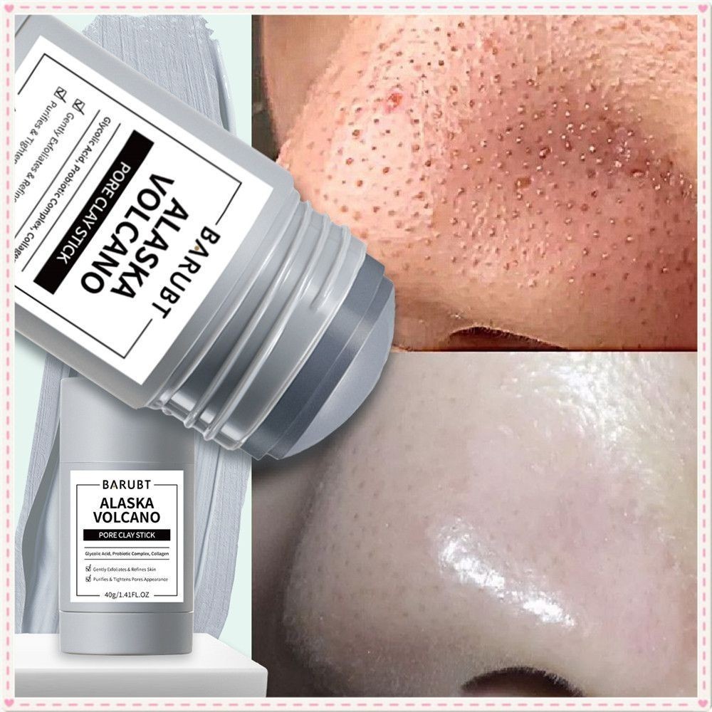 BARUBT Volcanic Mud Mask Reduce Blackheads Deep Pores Cleansing Clay ...