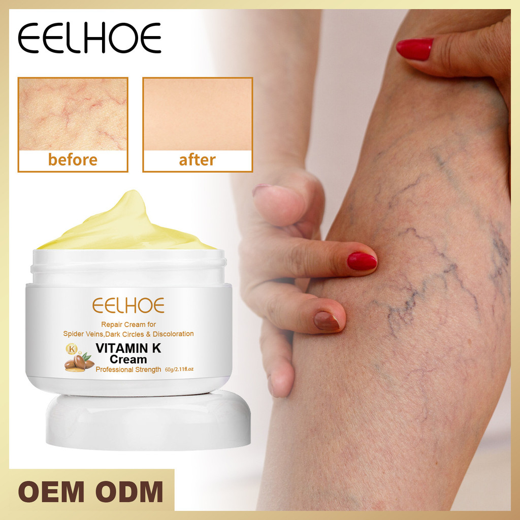 Eelhoe Vitamin K Cream Leg Green Muscles Raising Swelling Earthworm Leg ...