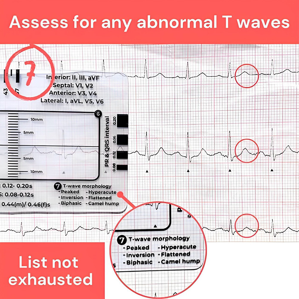 [Seriena.my] ECG 7 Step Ruler Portable ECG Measuring Card Reference ...