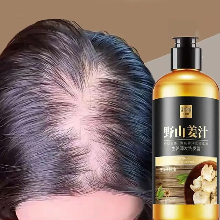 Ginger Shampoo Fast Hair Growth Anti-Dandruff Shampoo / Anti-Dandruff ...