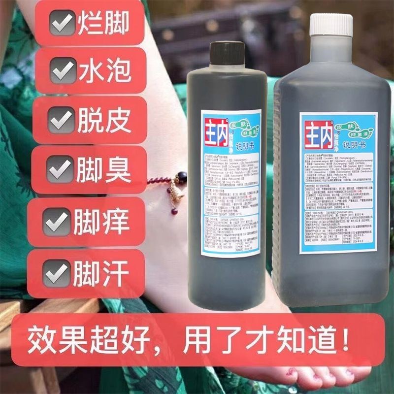 Air bubbles on feet, watery feet, peeling feet, itchy feet, feet Bubble ...