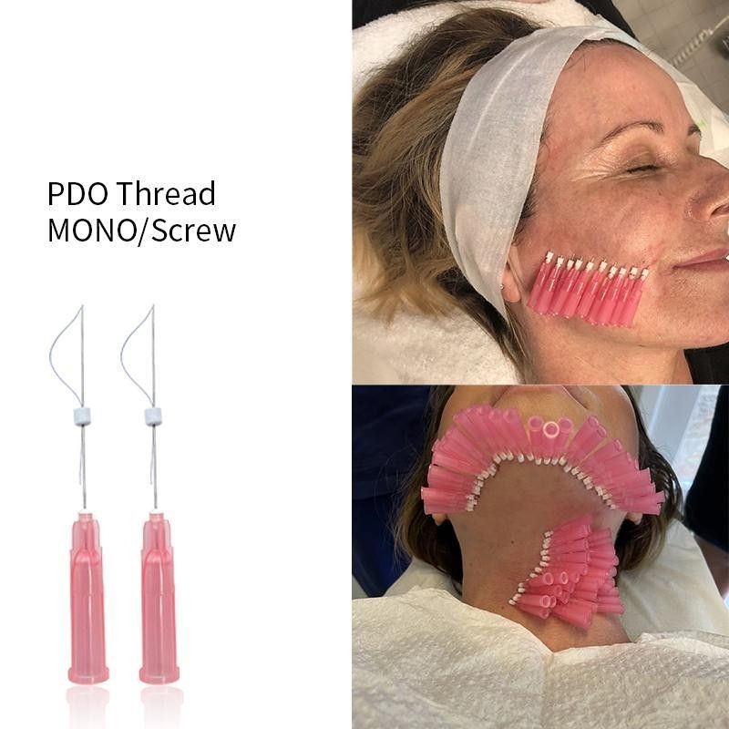 20Pcs/pack Minerva Thread Pdo Screw/Mono Thread Lifting Premium for Removing Wrinkle | Shopee ...