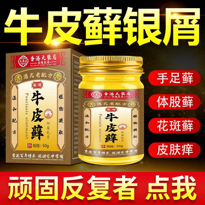 Psoriasis Cream Psoriasis Psoriasis Special Eczema Tinea Capitis Body ...