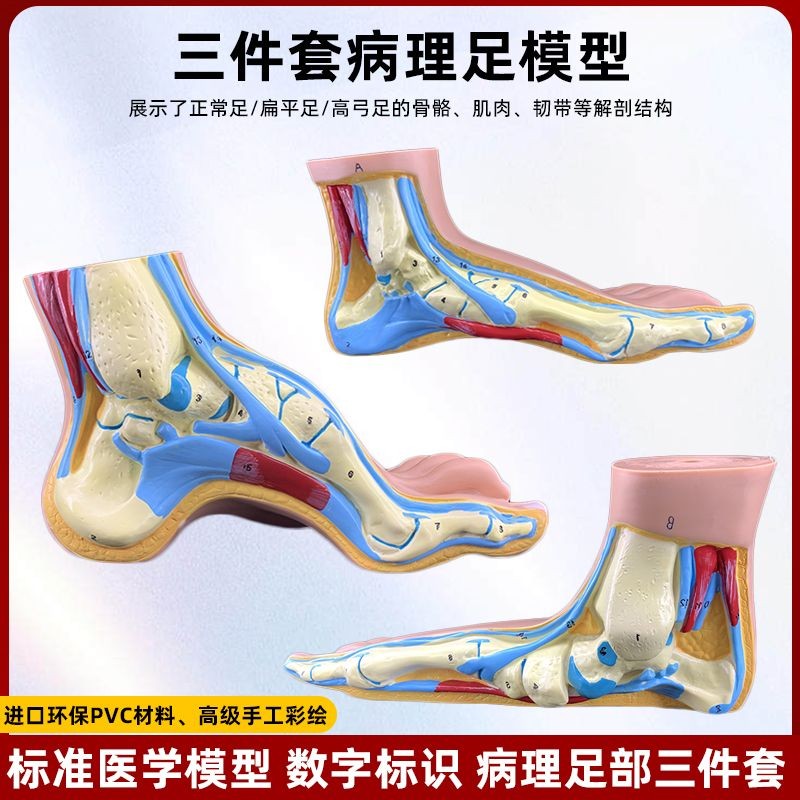 Simulation Human Foot Foot Foot Anatomy Model Normal Disease to Foot ...