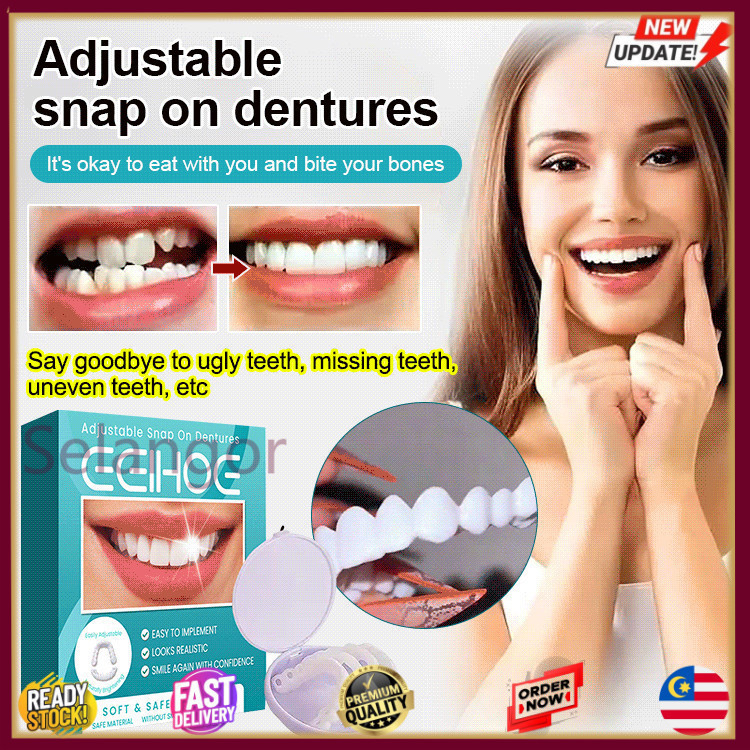 【Original】Adjustable Snap-on Dentures Temporary Adjustable Braces ...
