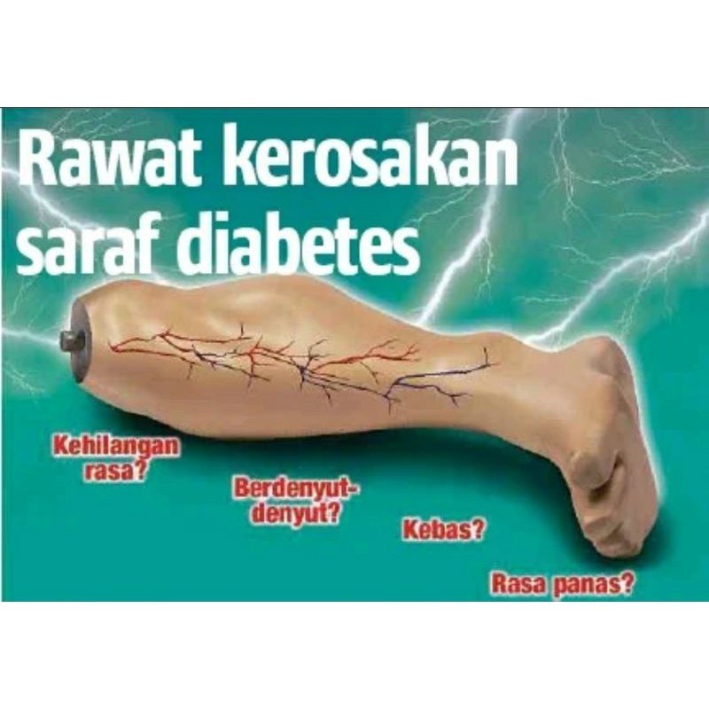Ubat Saraf/ Pil Sakit Saraf Urat / Vitamin Kebas Mecomin Vitamin B12 ...