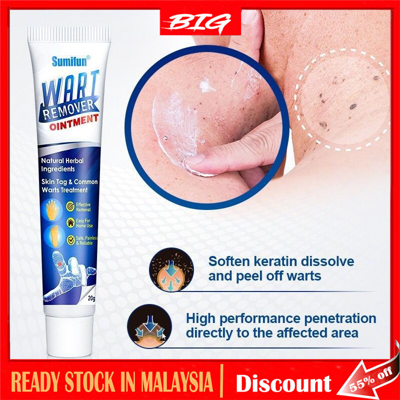 Sumifun Wart Removal Body Warts Treatment Cream Skin Tag Remover ...