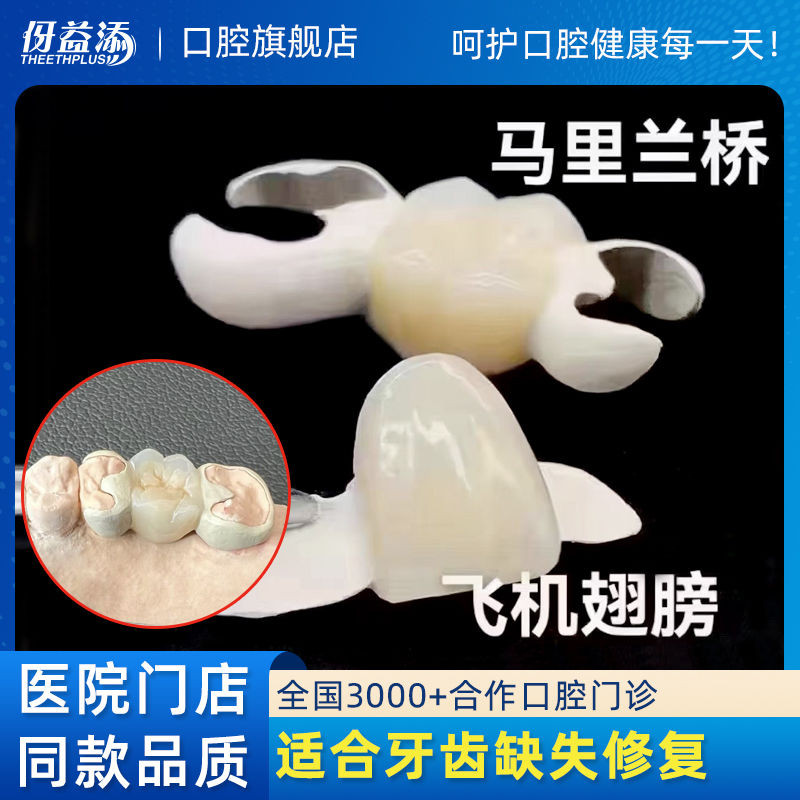 Hp hpp Bonding Bridge Maryland Bridge Missing Teeth All Porcelain Teeth ...