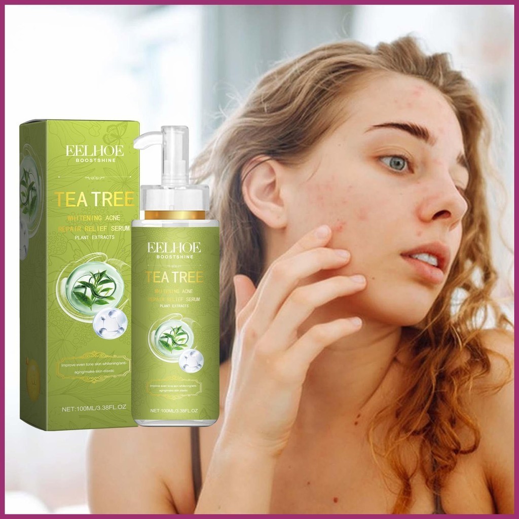 Pimple Essence for Face Brightening Essence Pimple Essence Natural ...