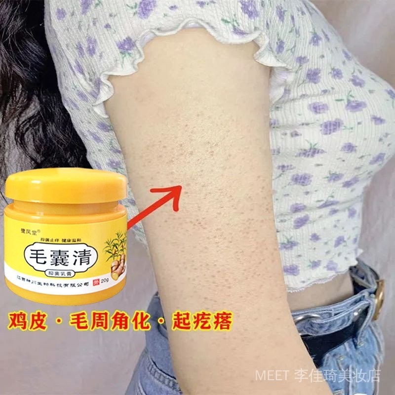 Hair Follicle Clearing Cream Exfoliating Skin Hair Follicle Cuticles ...