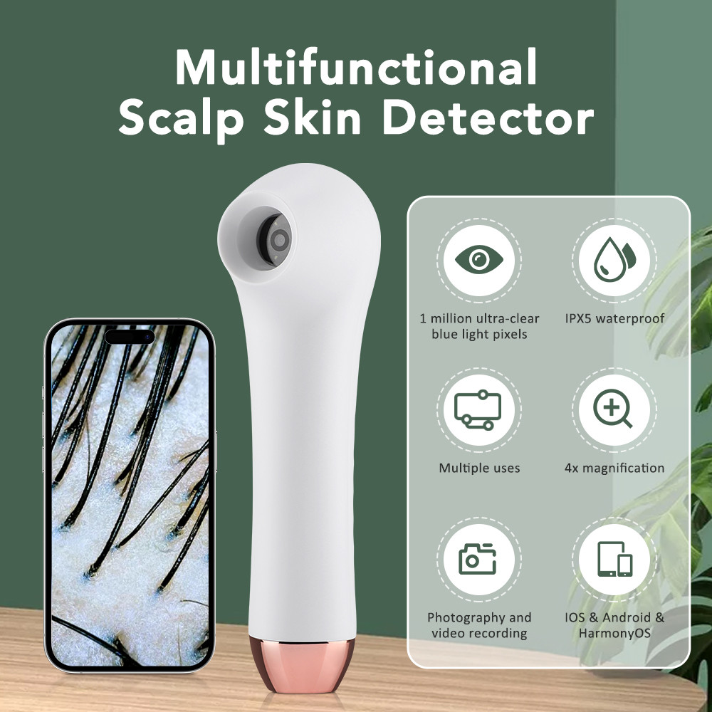 Portable HD Scalp Follicle Skin Analyzer Blackhead Pore Detection ...