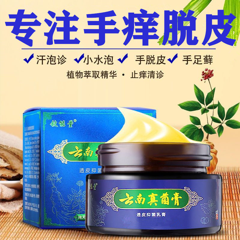 Skincare skincare Hand Itching Peeling Cream Hand Foot Ups Special ...